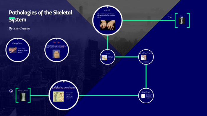 Pathologies of the Skeletal System by sue craven on Prezi