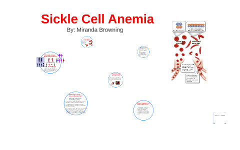 Sickle Cell Anemia by Miranda Browning on Prezi