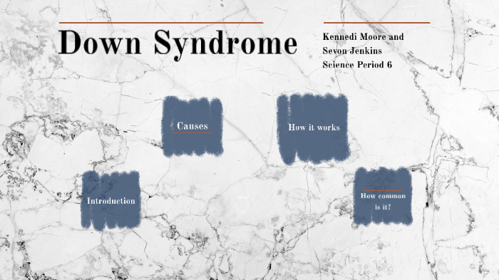 Down Syndrome by Kennedi Moore on Prezi
