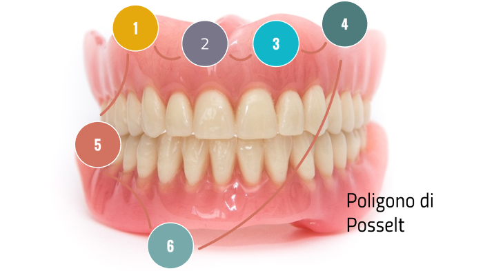 Poligono di Posselt by Giulia Binato on Prezi