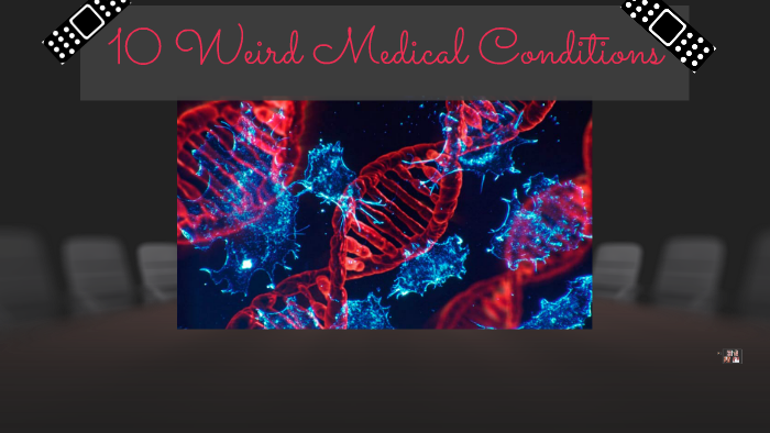 10 Weird Medical Conditions That Will Shock You By Jessica Lascurain 10-weird-medical-conditions-that-will-shock-you-by-jessica-lascurain