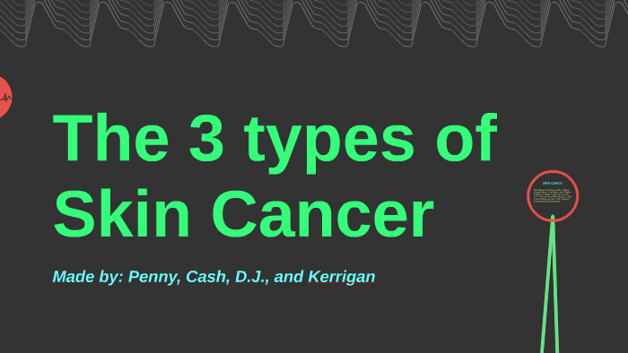 The 3 types of Skin Cancer by Penny Tagert on Prezi