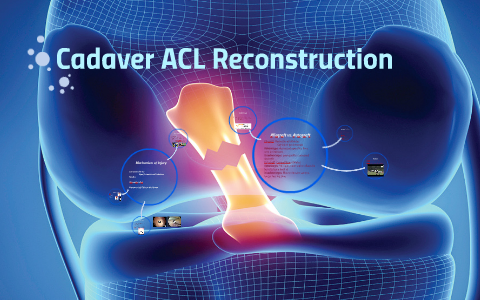 Cadaver ACL Reconstruction by Anna Flesher on Prezi