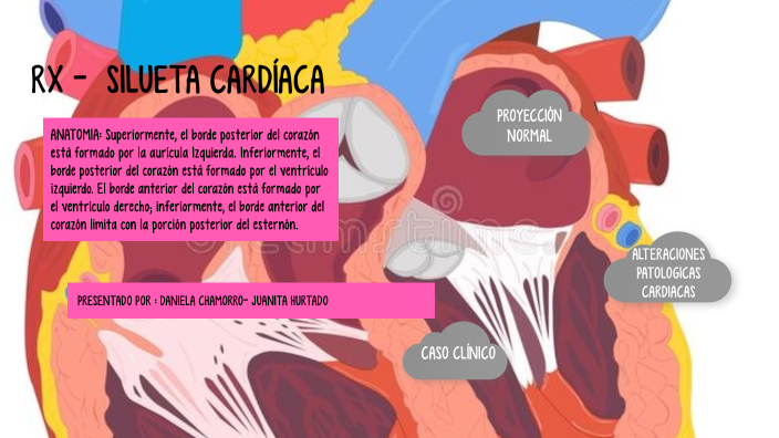 RX - SILUETA CARDIACA by Juanita Hurtado Galvis on Prezi
