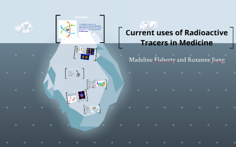Current uses of Radioactive Tracers in Medicine by Roxanne J on Prezi