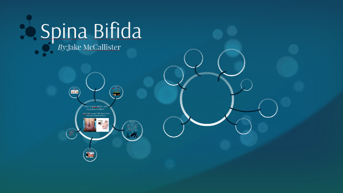Spina Bifida by Jake McCallister on Prezi Next