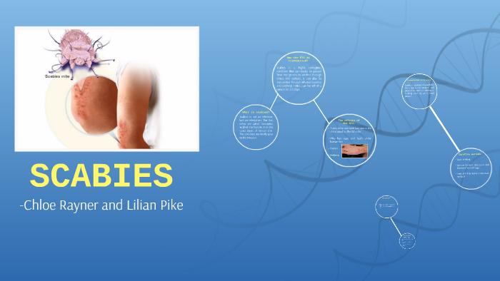 SCABIES by Chloe Rayner on Prezi