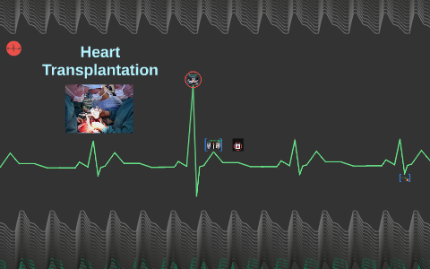 Heart Transplantation by warda rehman on Prezi