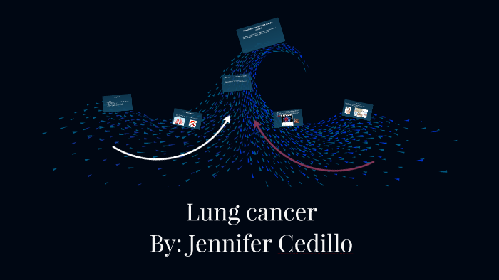 Lung cancer by Jennifer Cedillo