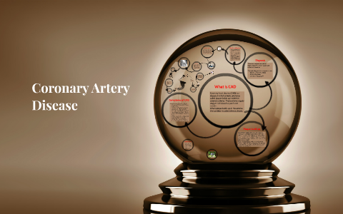 Coronary Artery Disease by Joshua Beamer on Prezi