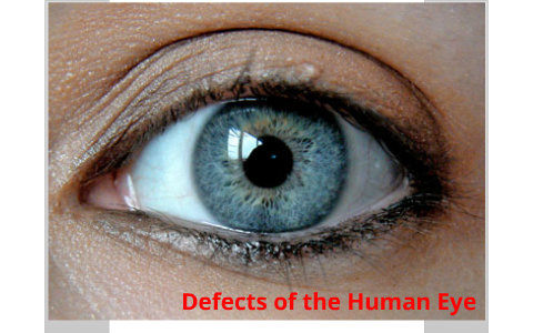Defects of the Human Eye by Tori Carlson