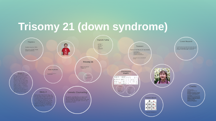 Trisomy 21 (down syndrome) by jennifer parrott on Prezi