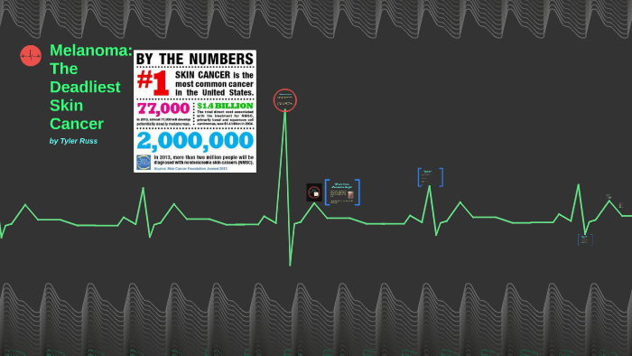 Melanoma: The Deadliest Skin Cancer by Tyler Russ