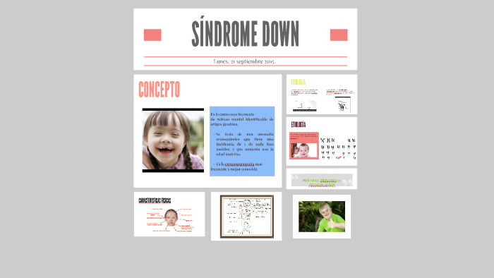 SINDROME DOWN by ALEXIS RASCON PALMA on Prezi