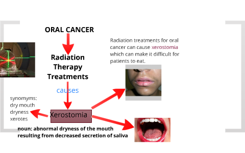 RADIATION THERAPY MEDICAL TERMS by Karen Day on Prezi