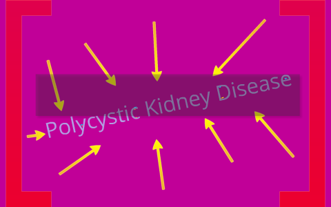 Polycystic Kidney Disease by Becky Klassen on Prezi