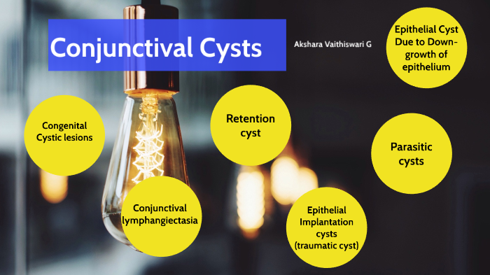 Conjunctiva- Cysts by Akshara Gopiswaminathan on Prezi
