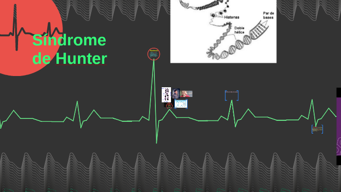 Síndrome de Hunter by Romy Cardiello on Prezi
