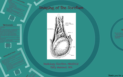 Imaging of the Scrotum by Katy Wummel on Prezi