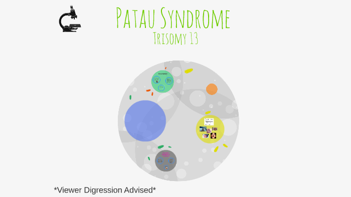 Patau Syndrome by on Prezi