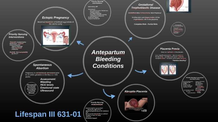 Antepartum Bleeding by Angela Kastner on Prezi