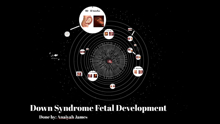 Down Syndrome Fetus Development by A J on Prezi