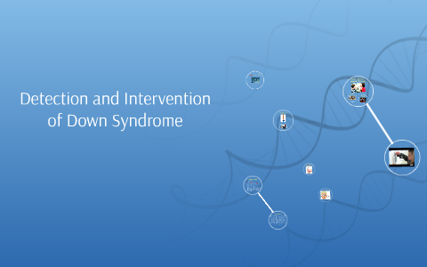 Detection and Intervention of Down Syndrome by Mary Collins Atkinson on ...