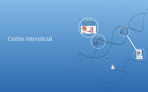Cistitis Intersticial by Tatiana Torres on Prezi