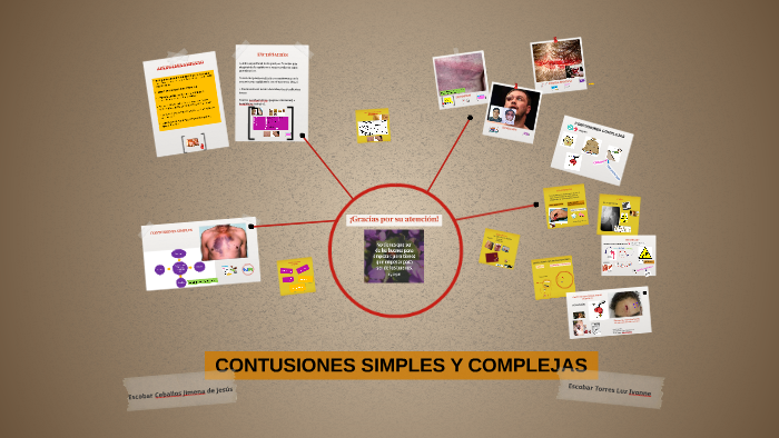 CONTUSIONES SIMPLES Y COMPLEJAS by Luz Escobar on Prezi