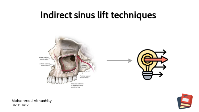 Indirect sinus lift techniques by Mohammed Almushity on Prezi