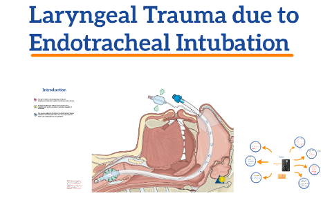 Laryngeal trauma due to endotracheal intubation by soumya reddy on Prezi