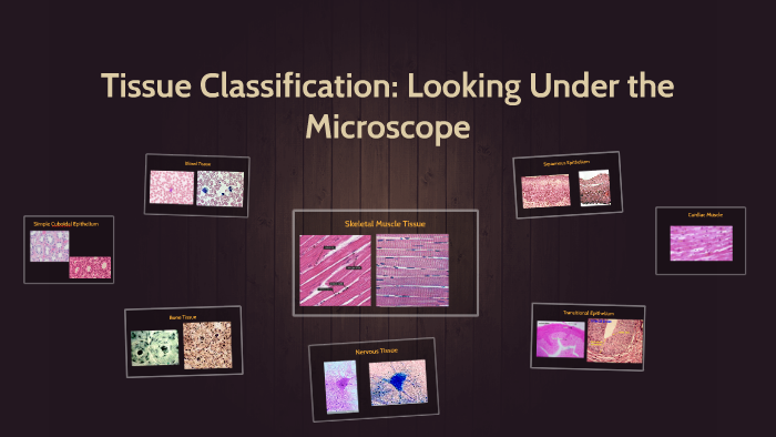 Tissue Classification: Looking Under the Microscope by Kendra Radnich ...