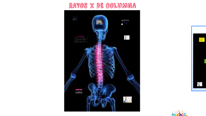 RAYOS X DE COLUMNA by michael sanchez on Prezi