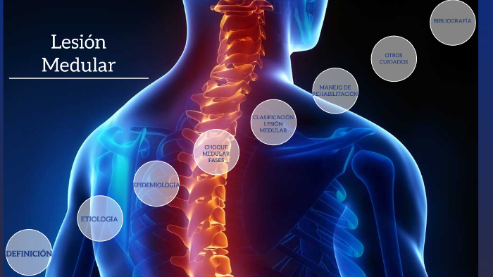 Lesión Medular by Clau Vallin on Prezi