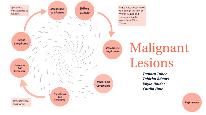 Abdominal Concept Map by Tamara Taber on Prezi