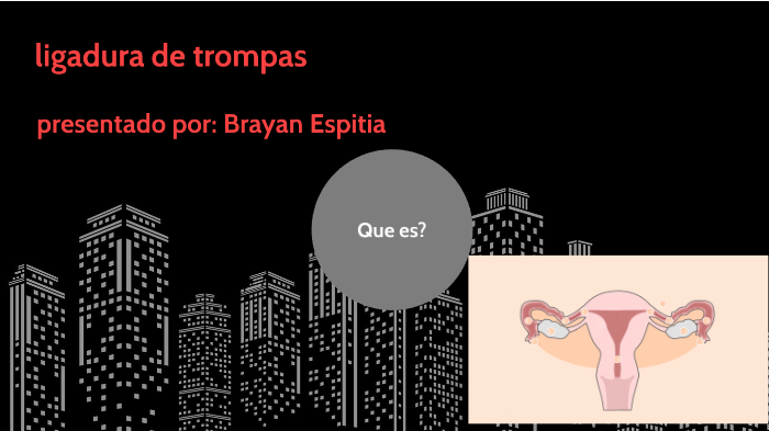 ligaduras de trompas by Brayan Stiven Espitia Perez on Prezi