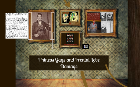 Damaged area of the brain by Anthony Papalia on Prezi