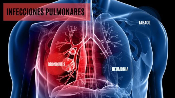 Infecciones pulmonares by Paula Sanchez on Prezi