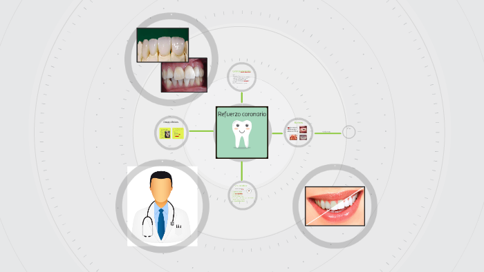 Refuerzo Coronario by Maribel Benavides on Prezi