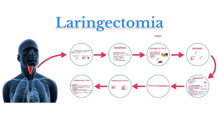 Laringectomia by Naiara Valentim Gomes on Prezi