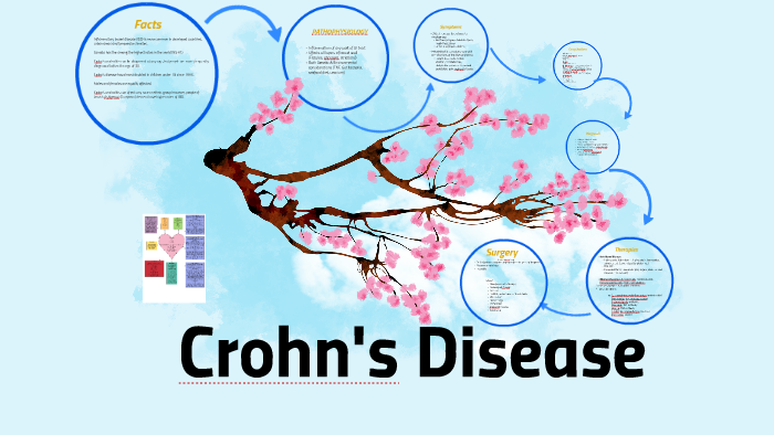 Crohn's Disease by Gillian Bent on Prezi