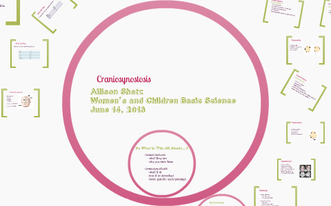 Craniosynostosis by Rhonna Shatz on Prezi