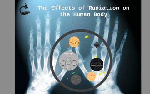 The Effects of Radiation on the Human Body by Abigail Marquis on Prezi