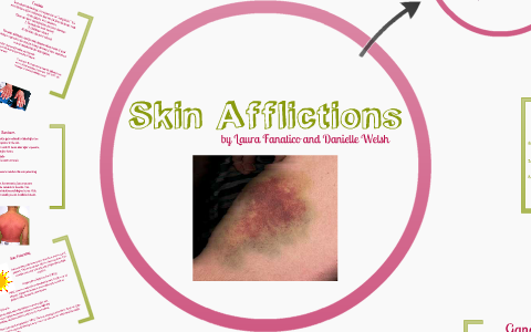 Skin Afflictions by Danielle Welsh on Prezi