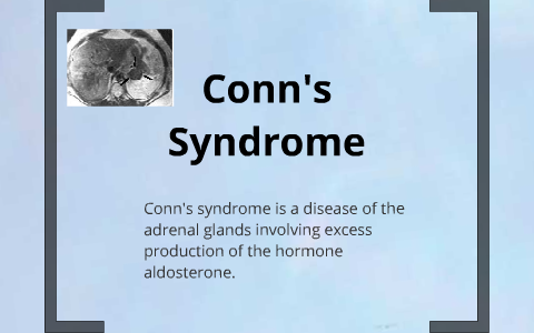 Conn's Syndrome by Rhett Lawson on Prezi