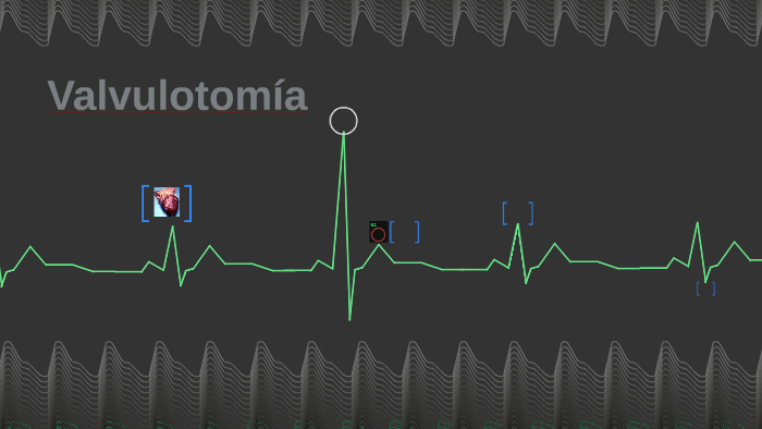 Valvulotomia by Carla Castro on Prezi