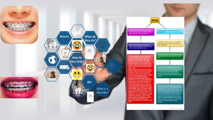 Braces by Amelia Briscoe on Prezi