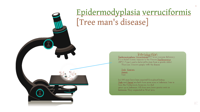 Epidermodyplasia verruciformis (Tree Man Disease) by Destiny Anudike ...