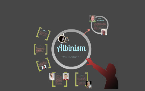 Albinism Presentation by Marie Duffy on Prezi