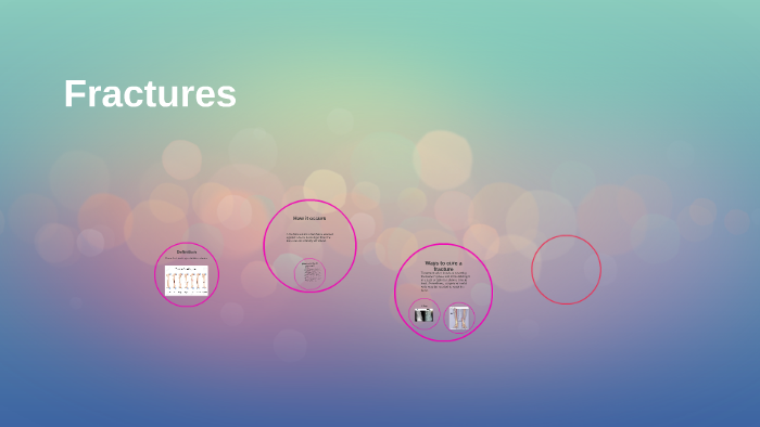 Fractures by Lexie Huffman on Prezi